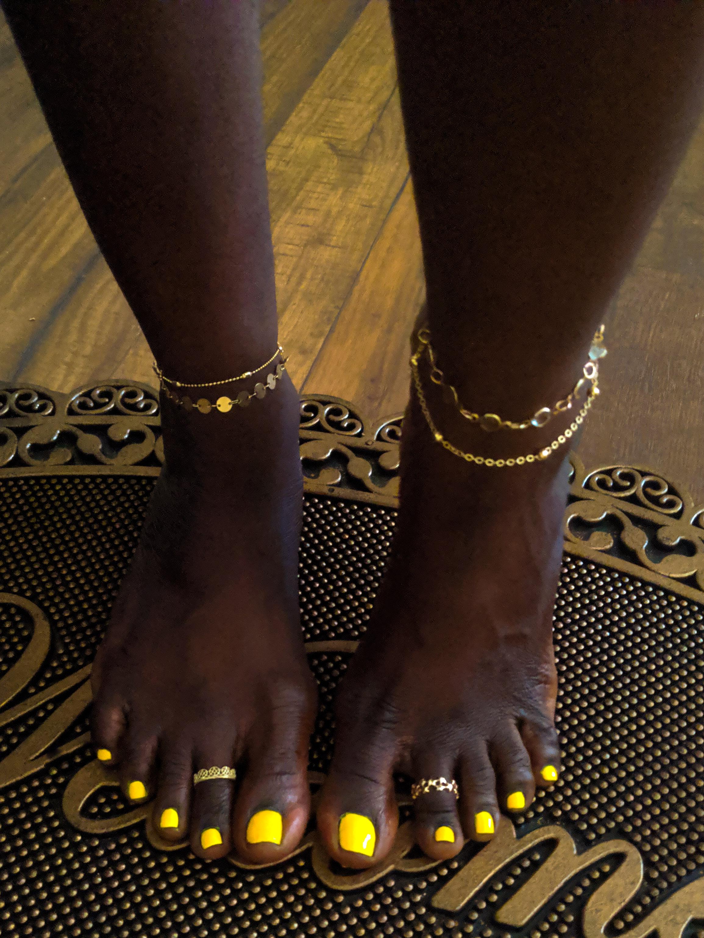 Yellow in the fall | Scrolller