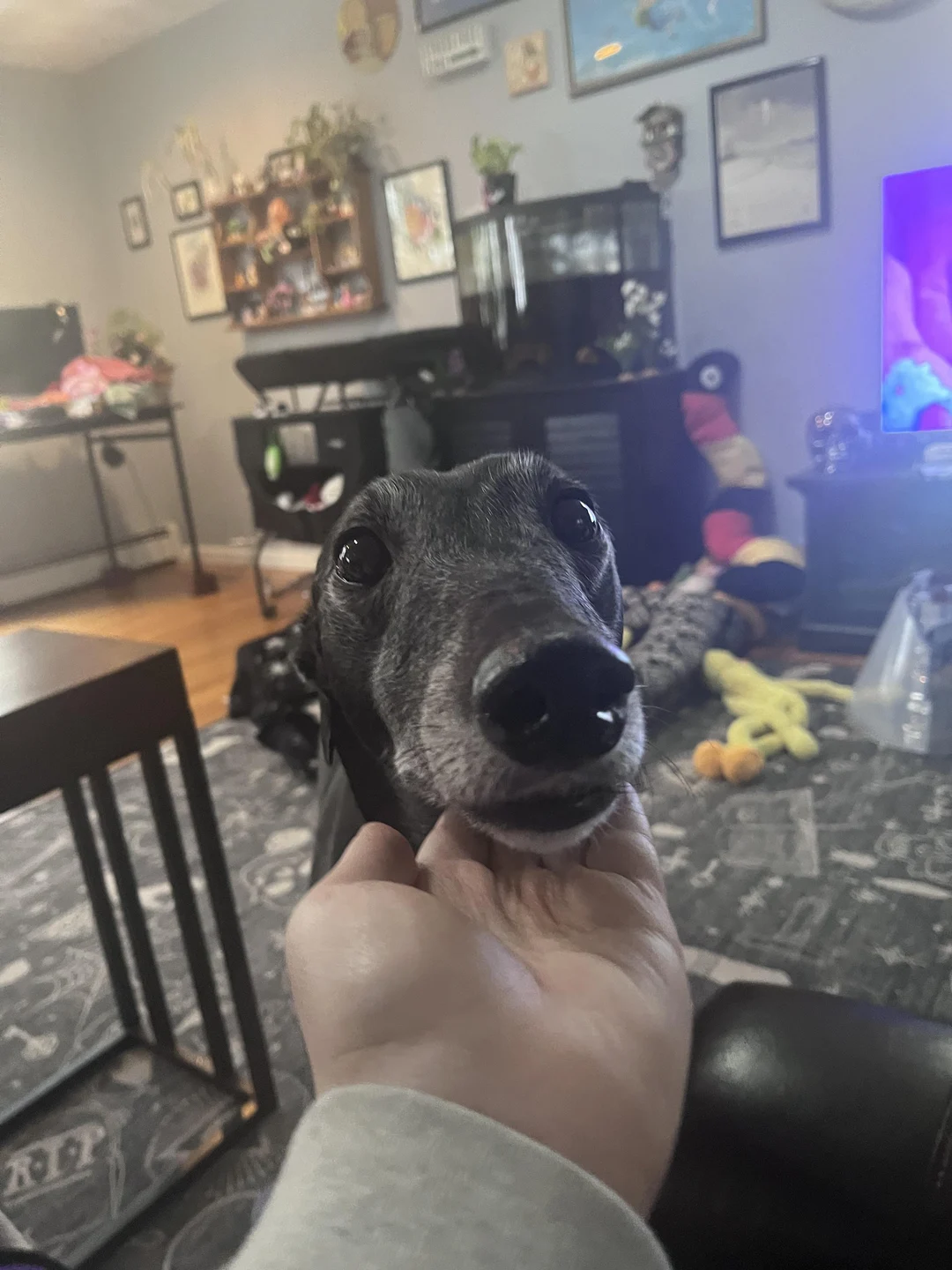 Symmetrical Lupoid Onychodystrophy | Scrolller