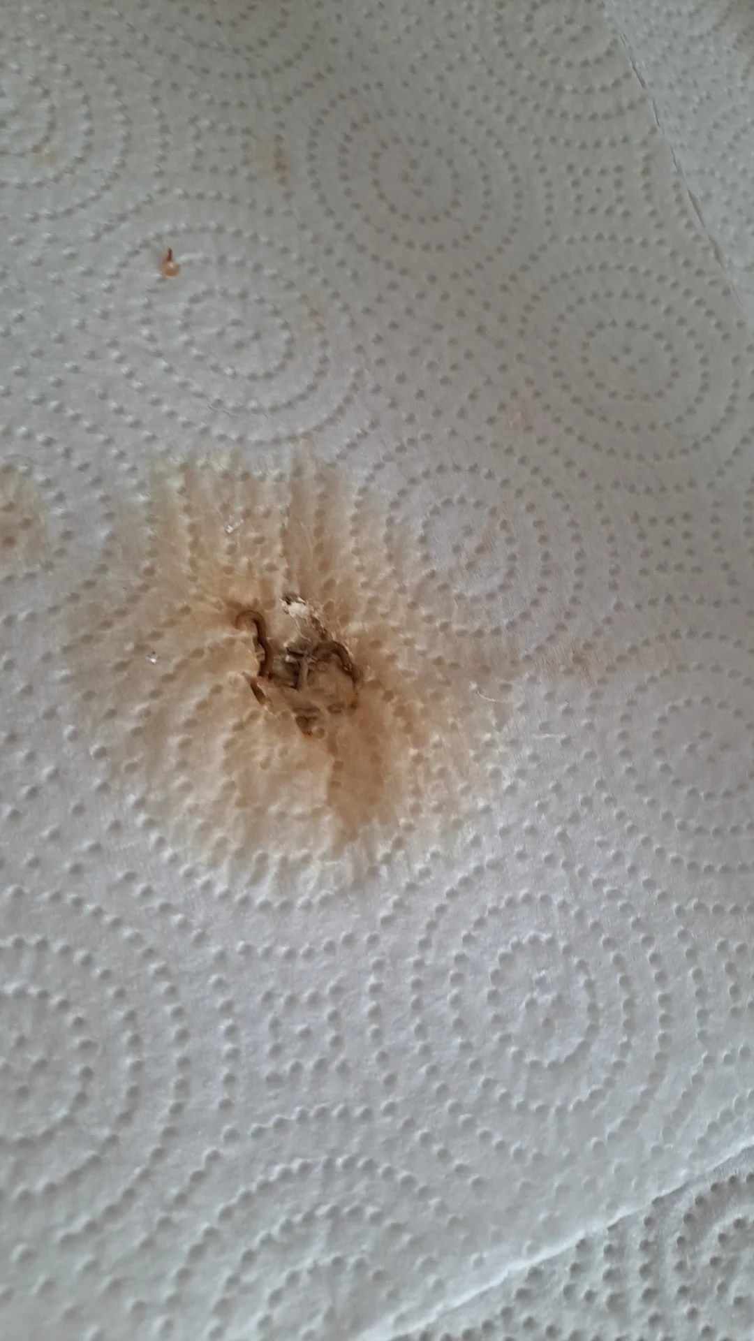 Please help!!! Is something wrongwoth his poop? | Scrolller