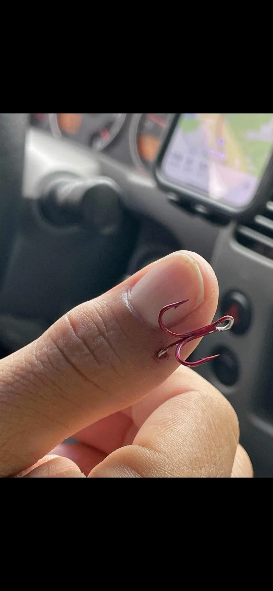 Dang fishhooks! | Scrolller