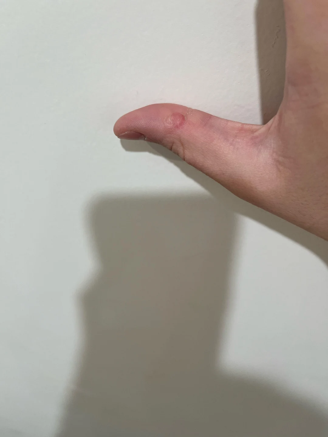 How do I heal this quicker | Scrolller