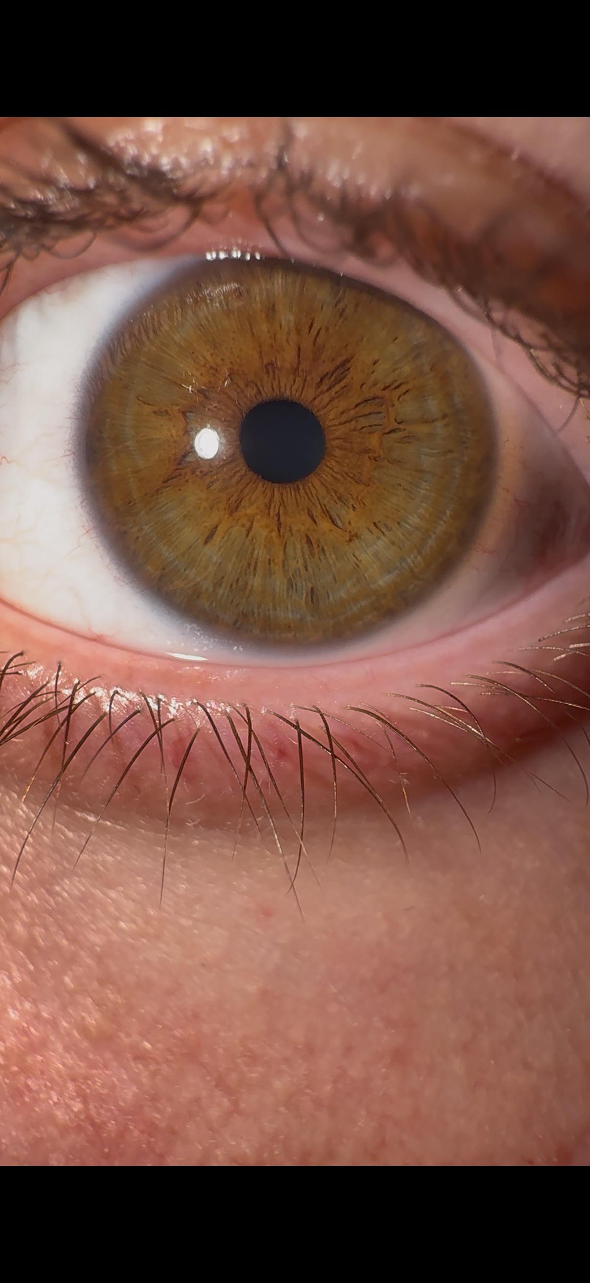 Brown or hazel? | Scrolller