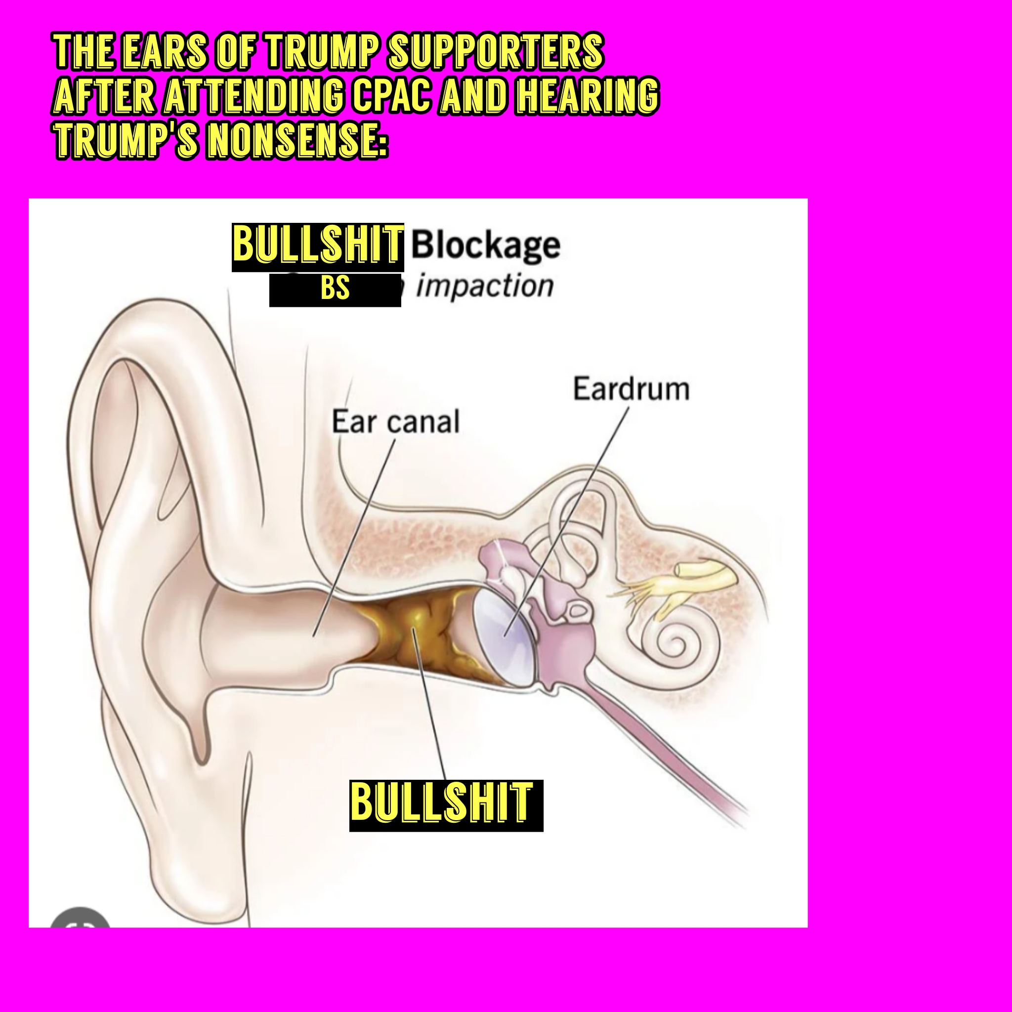 Their ears are clogged w/bs from hearing all of trump's nonsense ...