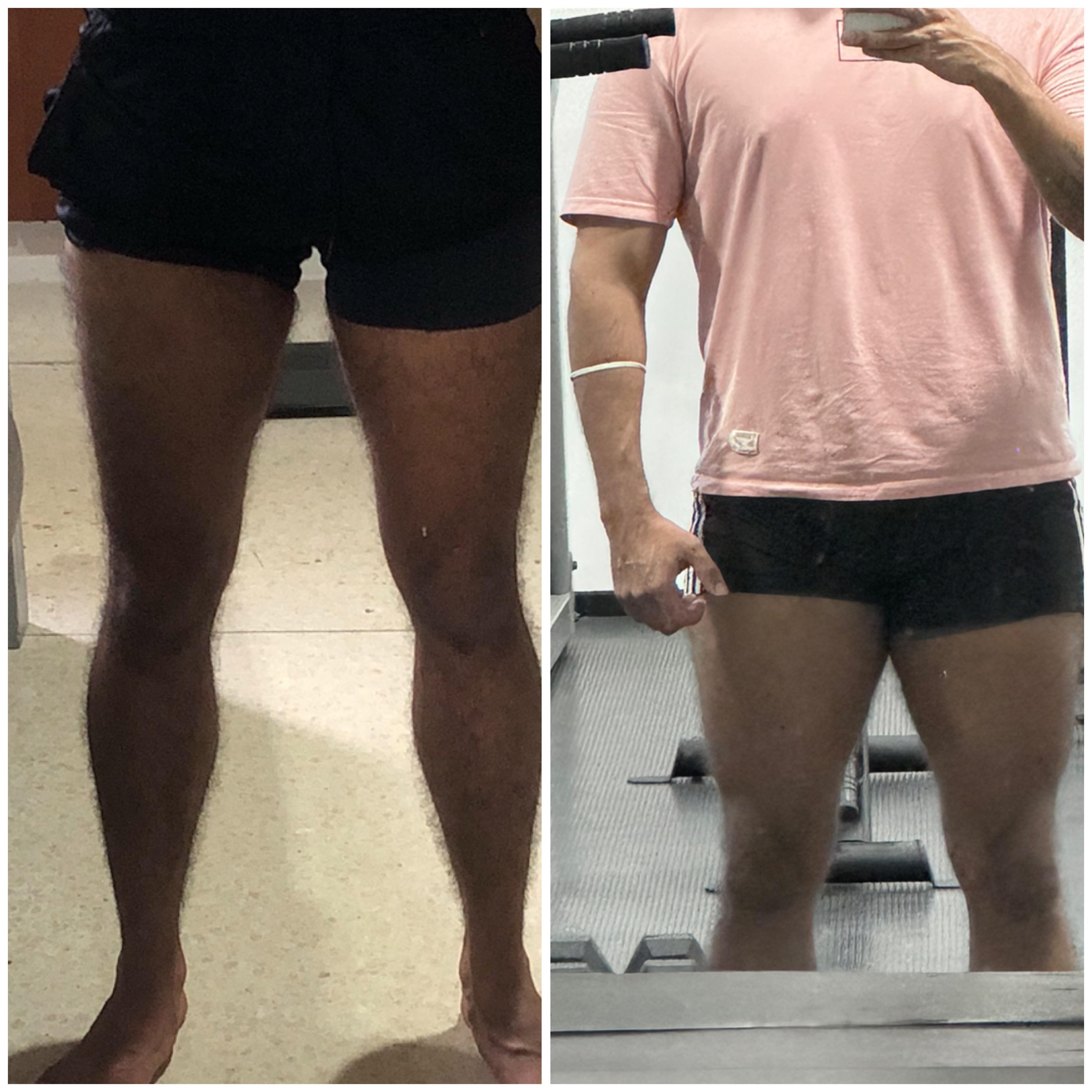 25 yo. Leg progress.Starting November 1st 2023 at 147lbs and ending on November 15th 2024 at ...