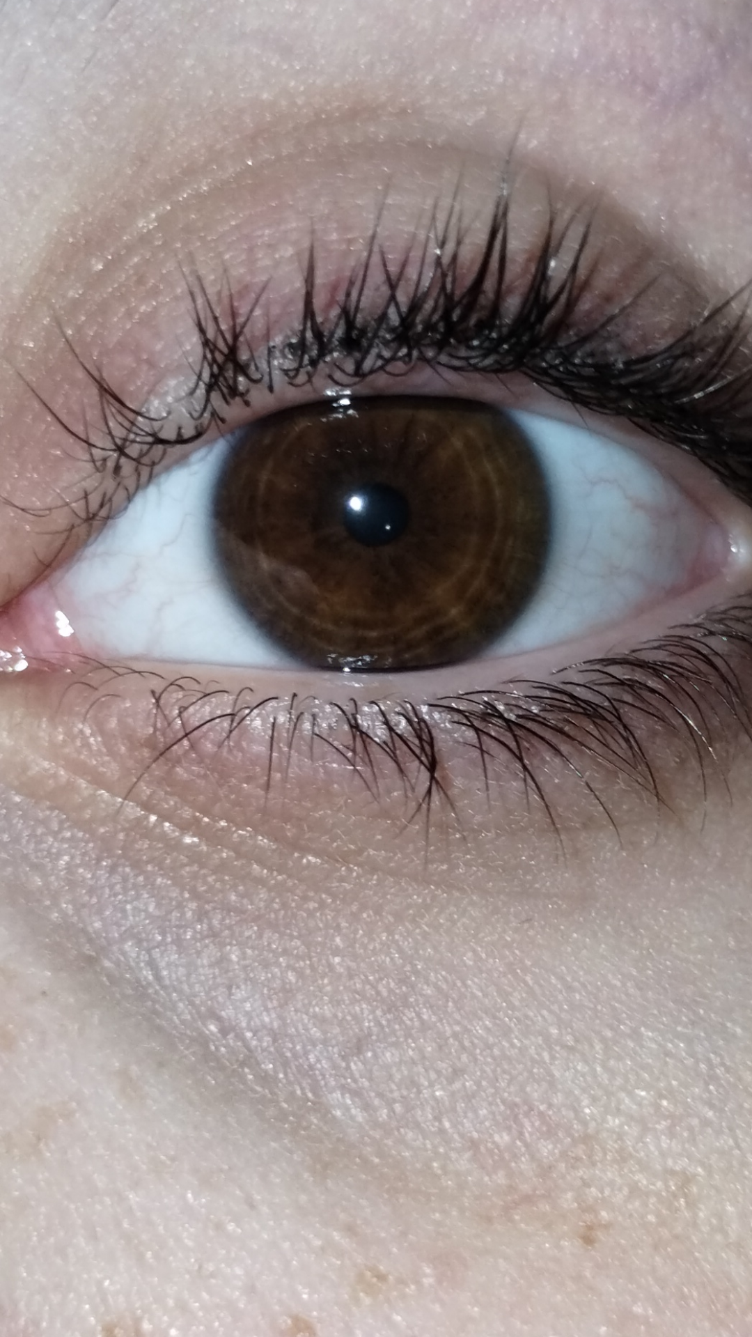 What are these rings in my irises? | Scrolller