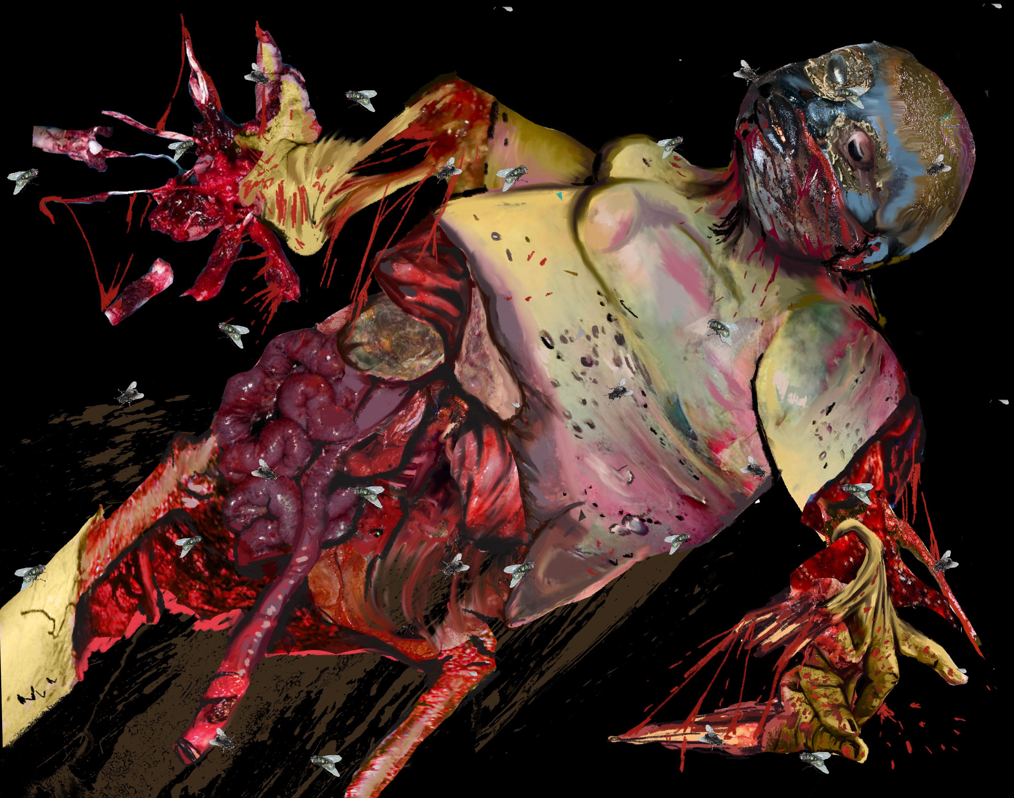 Rectal prolapse | Scrolller