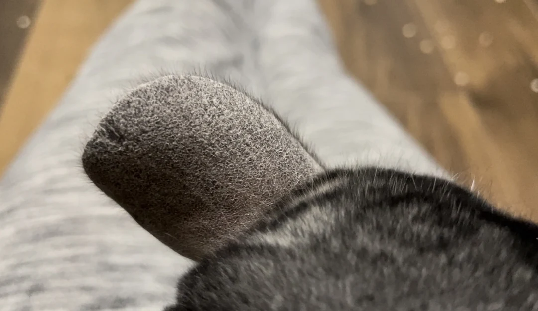 Does her ear look normal? It just looks really dry I guess. Is this ...