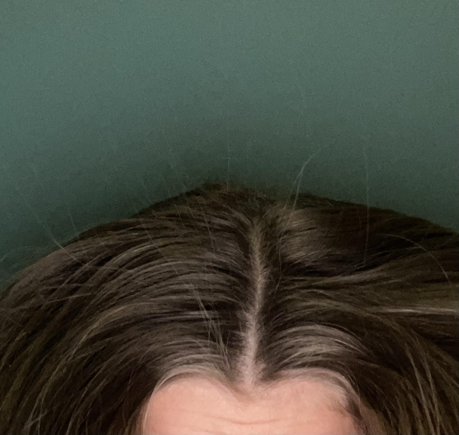 Why is my hair so oily? | Scrolller