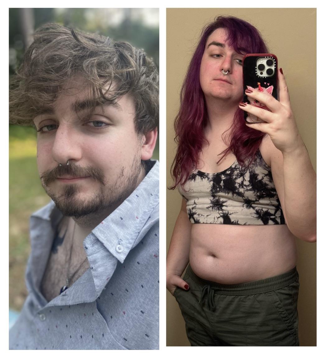 1.5 years before HRT (left) vs. 1.5 years of estrogen (right). HRT is magic | Scrolller