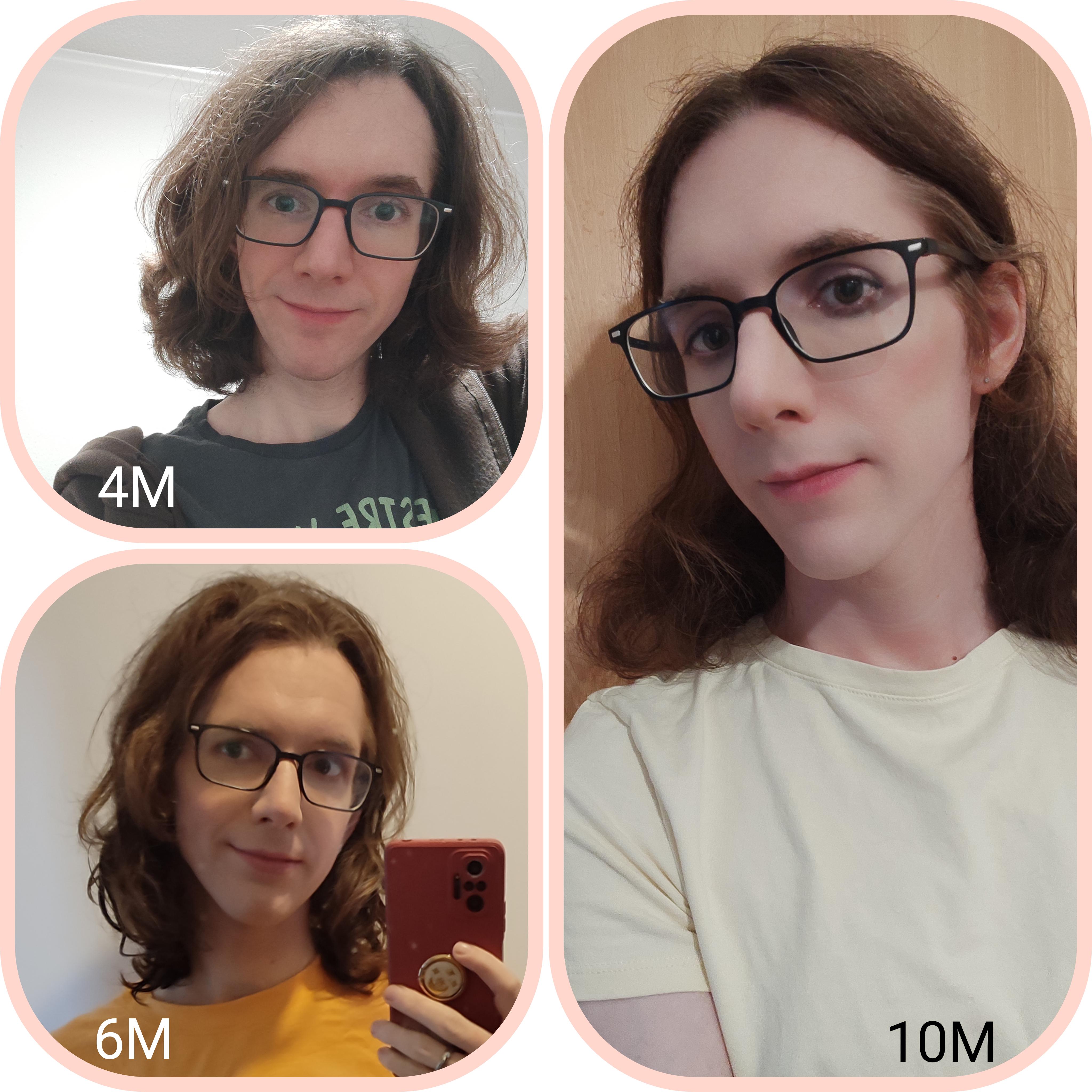 10 Month MTF | Scrolller