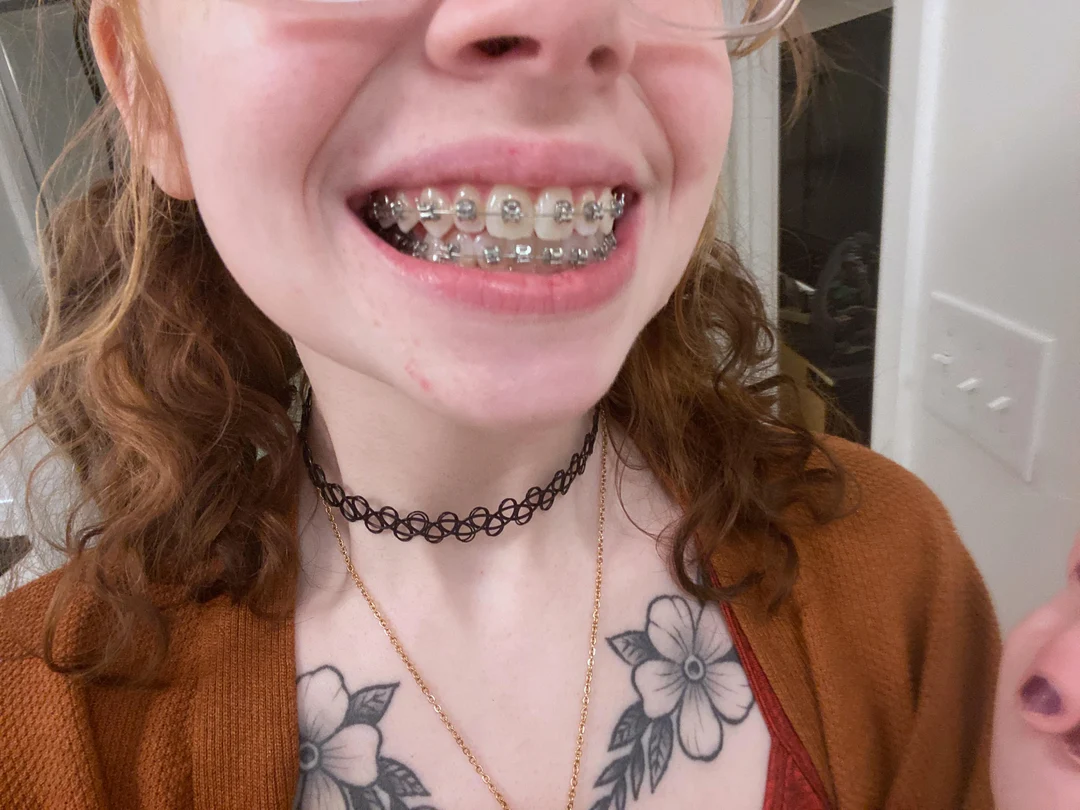 wanting to make the switch | Scrolller