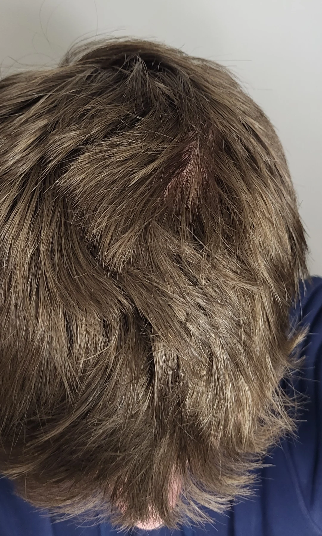 Why is my hair like this? | Scrolller