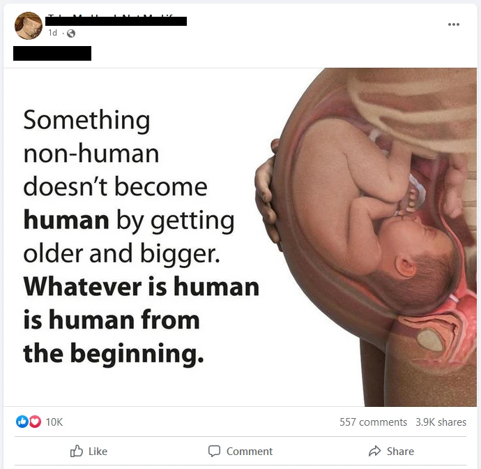 Sperm is human? | Scrolller