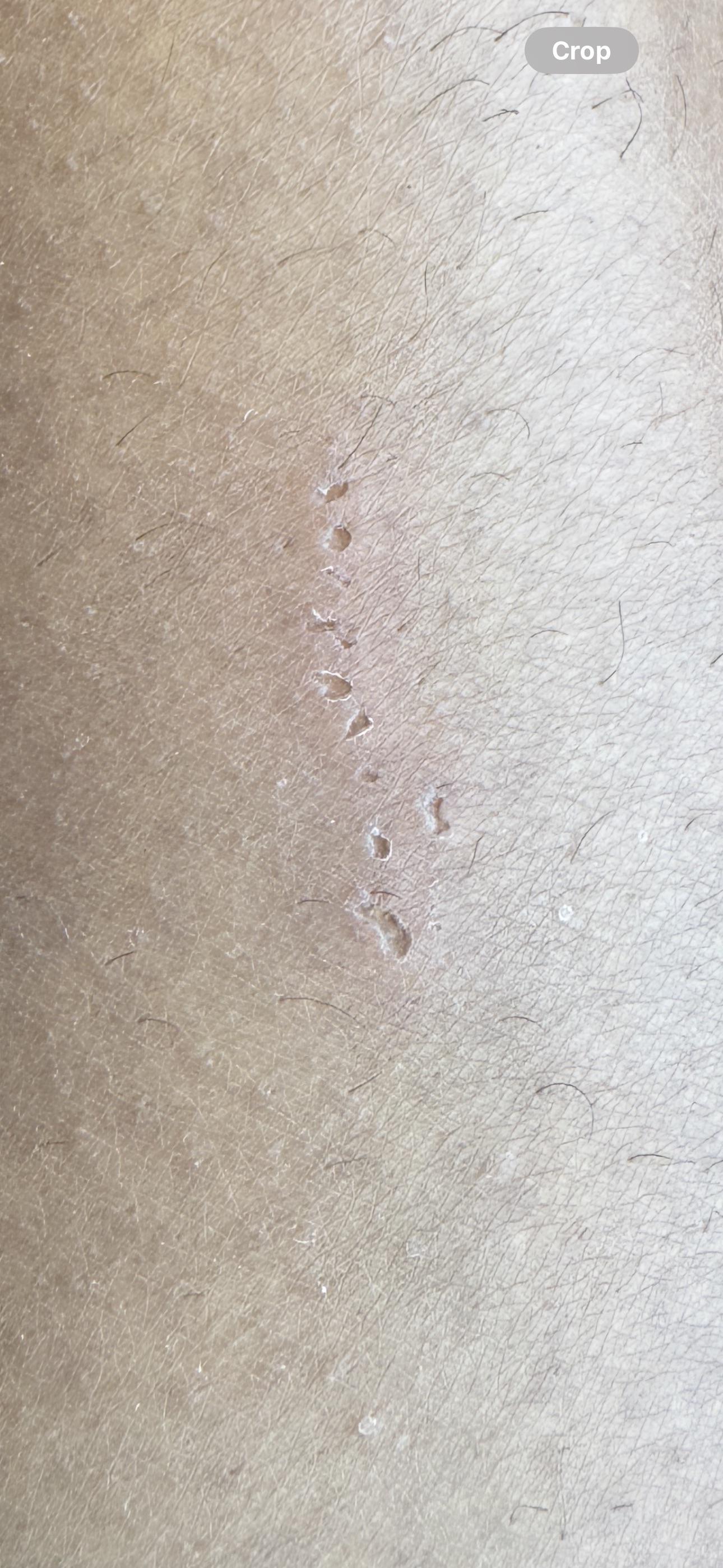 What is this?? On my leg | Scrolller
