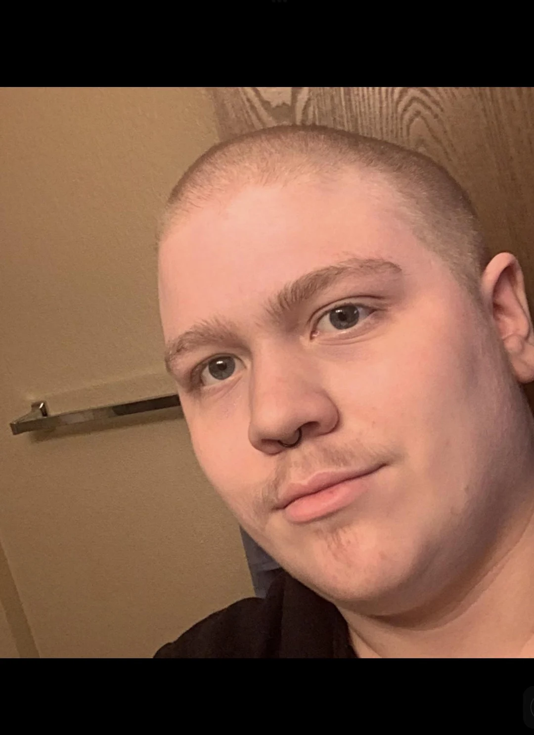 Ftm (almost 2 years on t, 4 days post op! | Scrolller