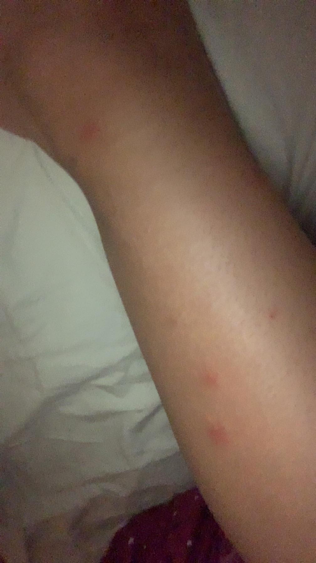 Discover more like SkincareAddicts: Itchy Spots and Related Content | Scrolller