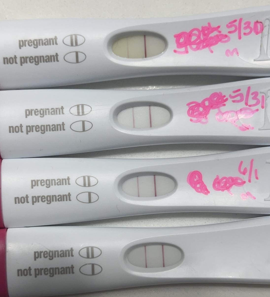 How’s the line progression? | Scrolller