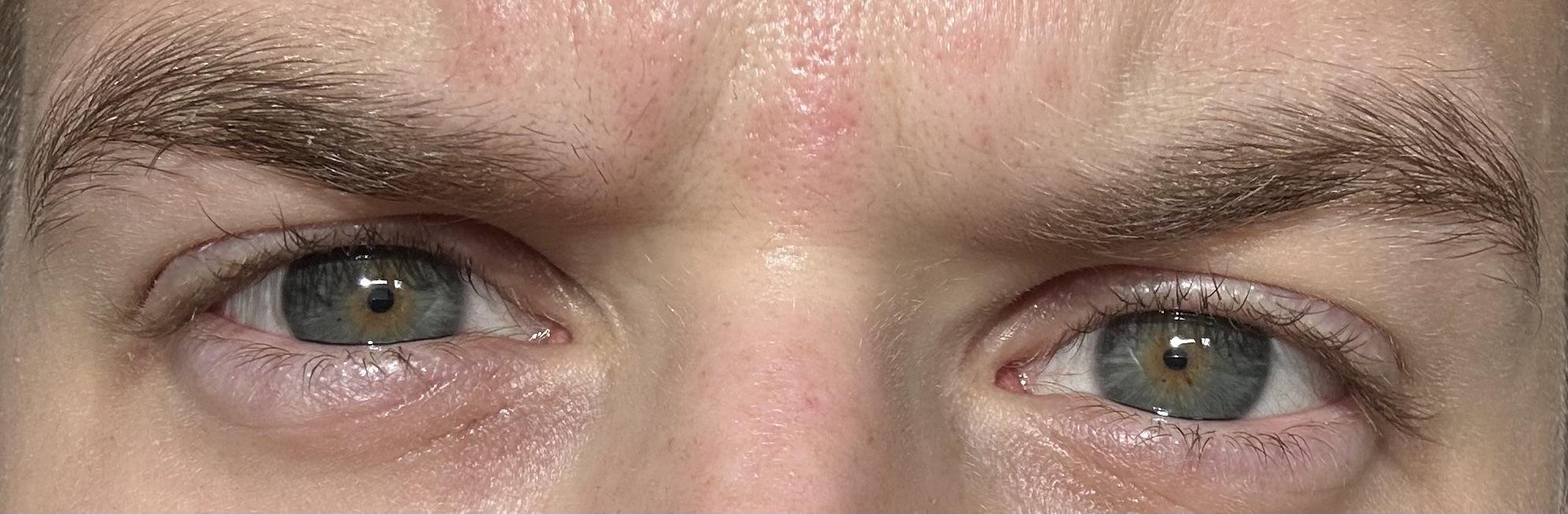 Gray hazel ish? | Scrolller