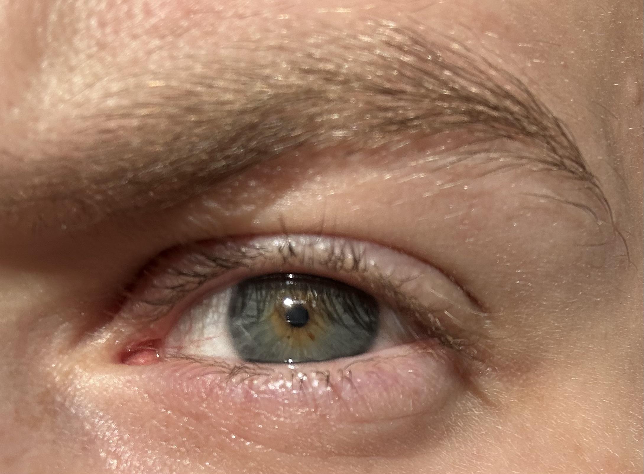 Gray hazel ish? | Scrolller