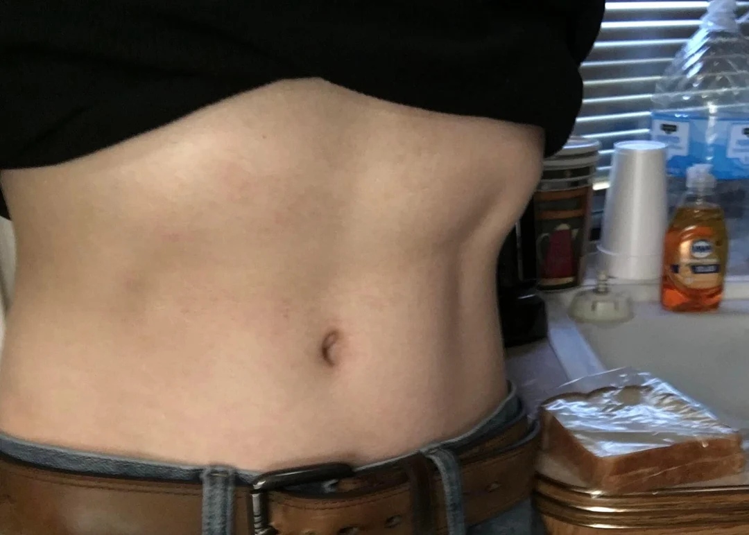 My stomach | Scrolller