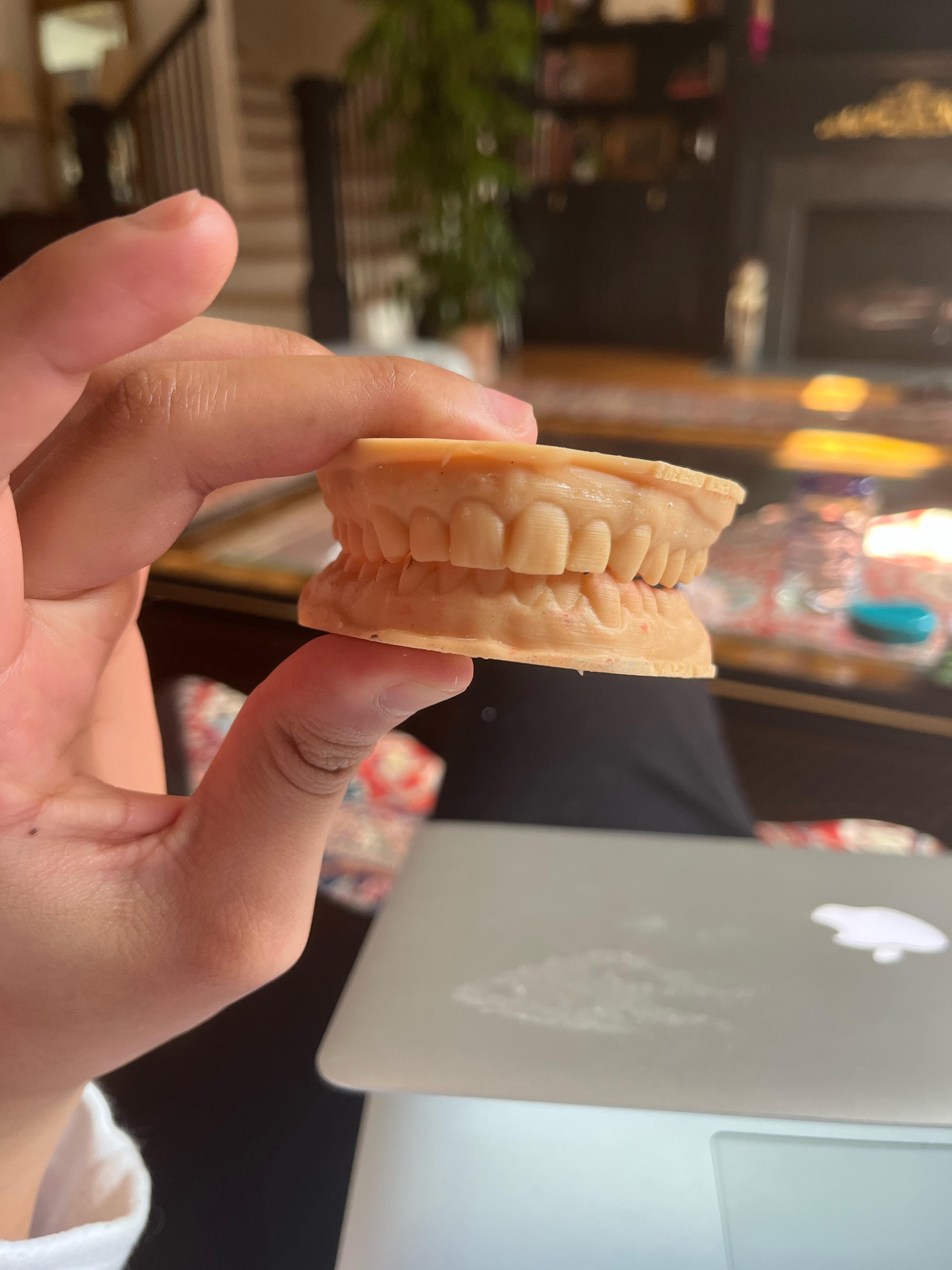 Here is a mold of my teeth. | Scrolller