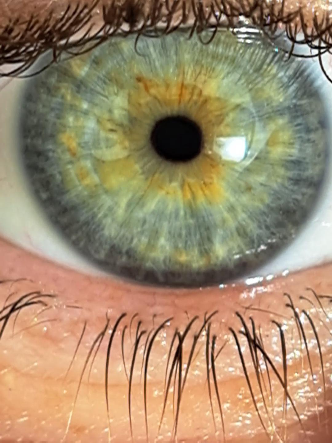 Eyes in natural sunlight | Scrolller