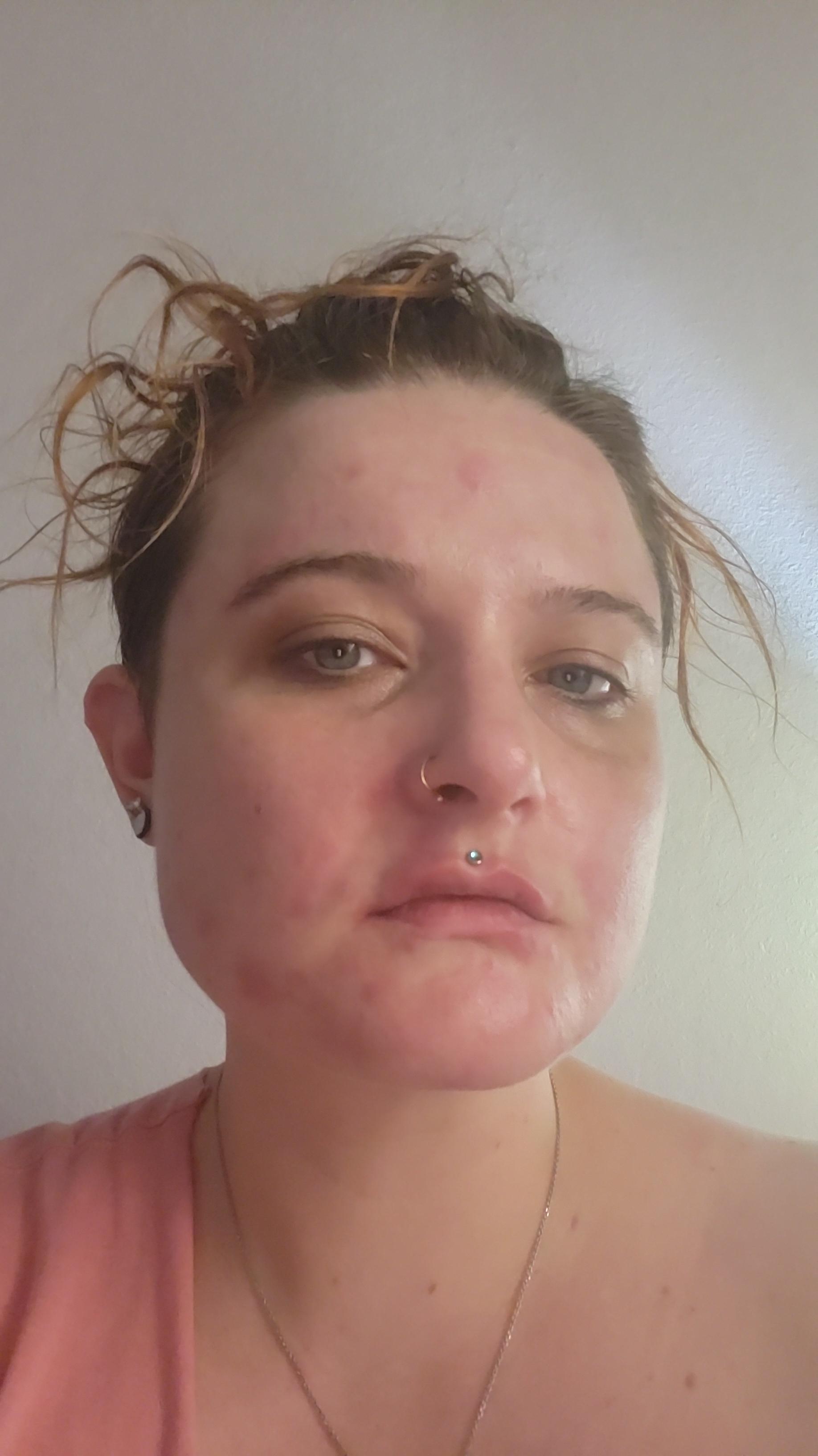 Native 2 n 1 curly hair causing redness on my face? | Scrolller