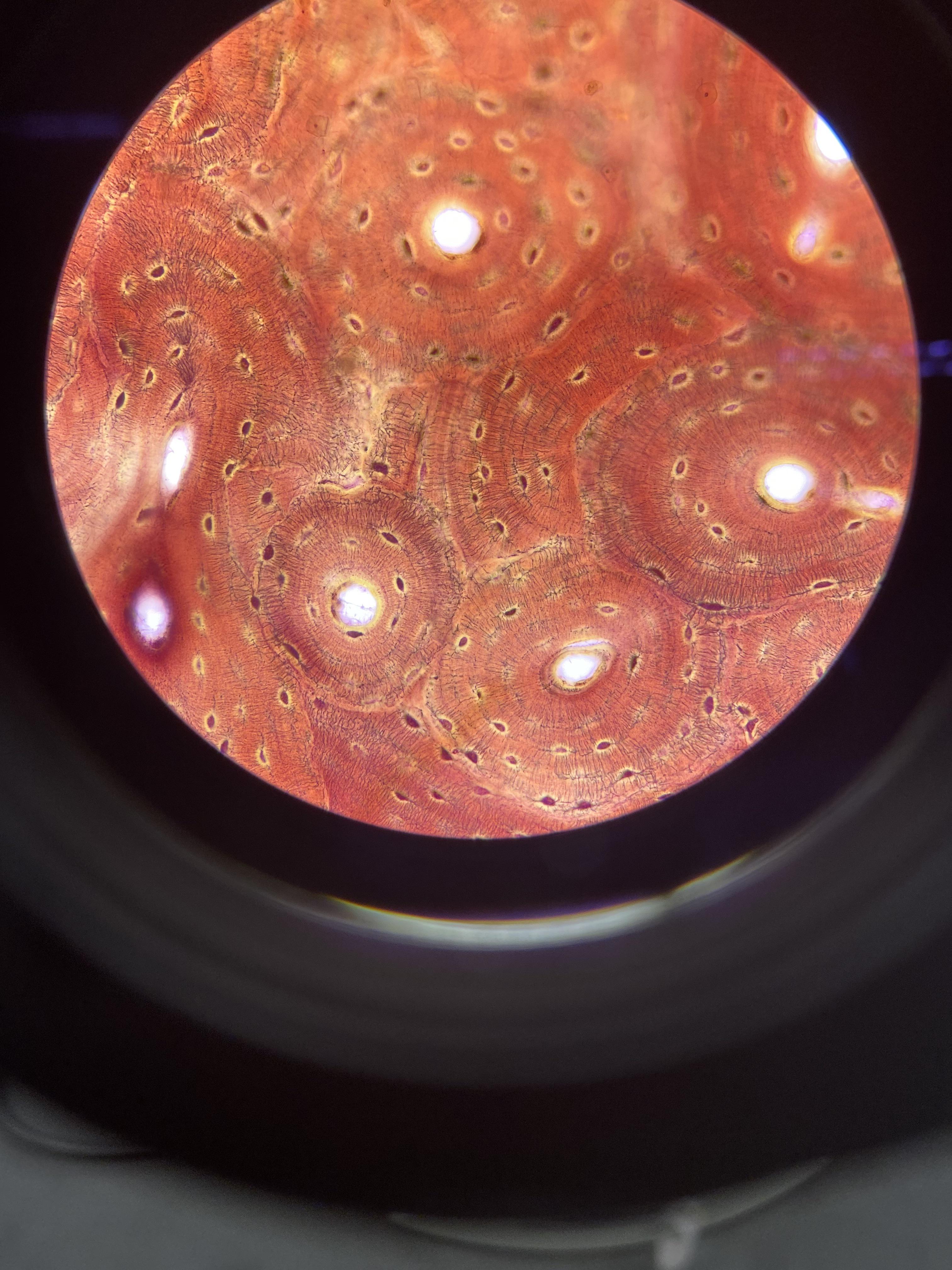 Human bone under a microscope! | Scrolller