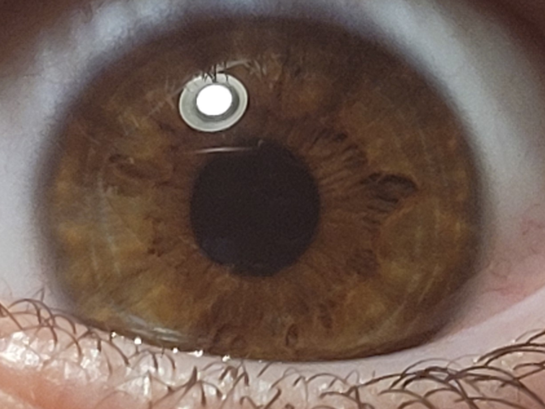 Are these hazel? | Scrolller