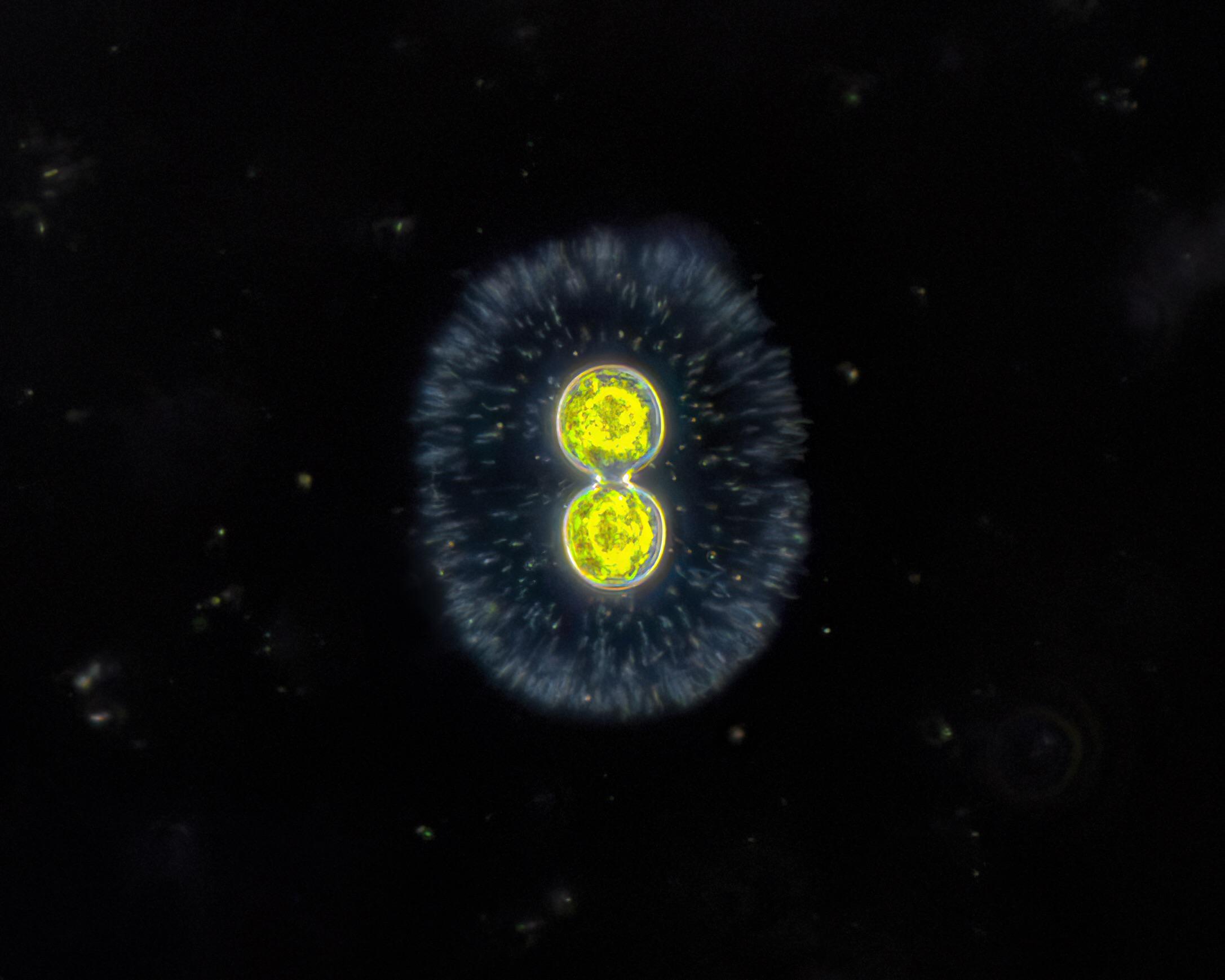 Algae under my microscope | Scrolller