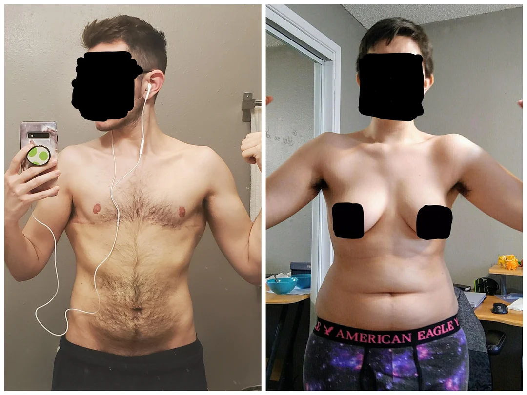 5.5 years on T, 3 years post-op | Scrolller