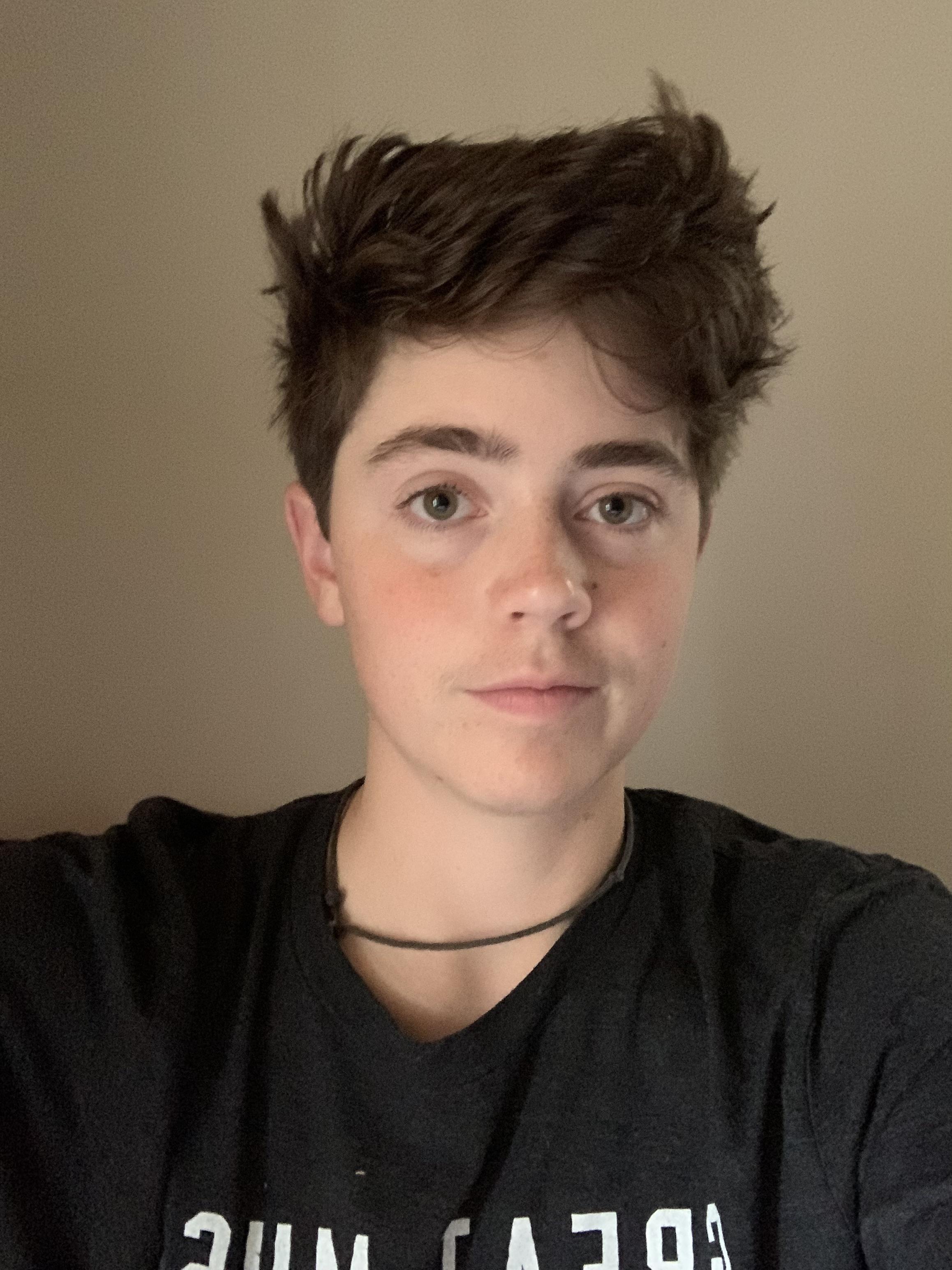 On T for almost 3 months, am i imagining the facial differences? | Scrolller