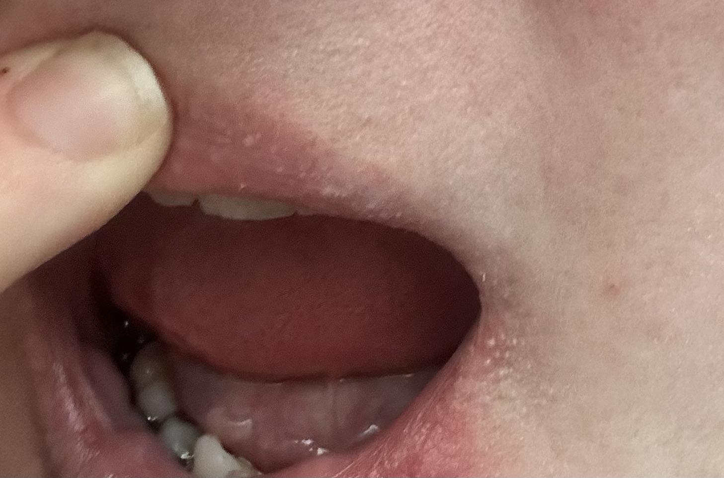 What are these white dots in my mouth? | Scrolller
