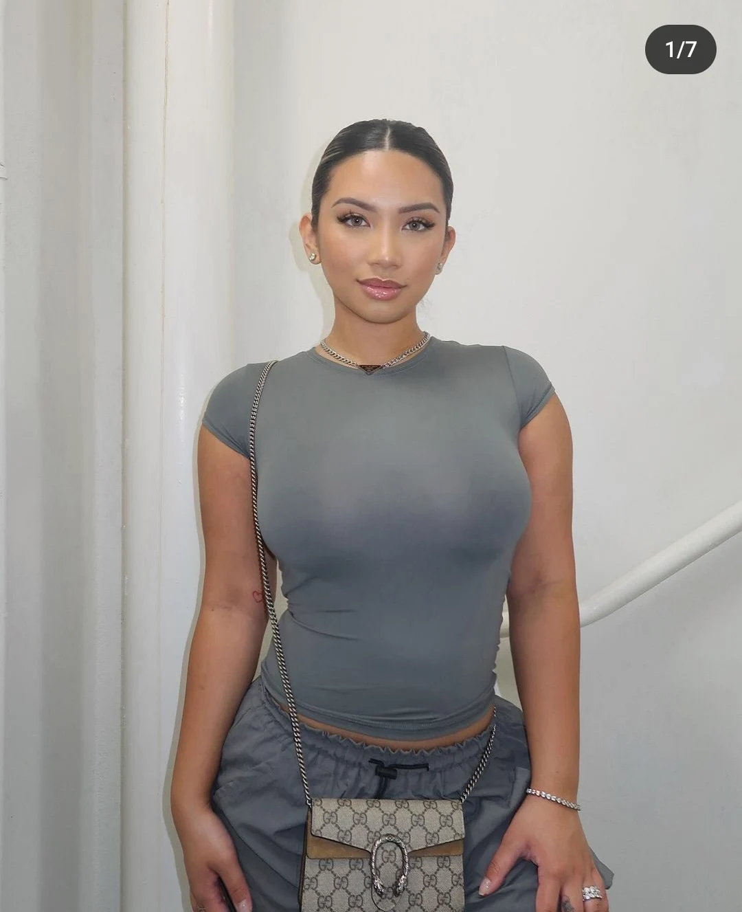 Yellow fever | Scrolller