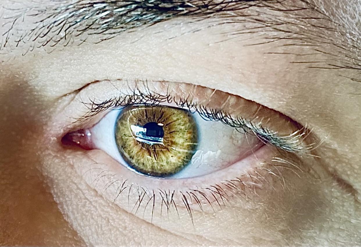 Would you consider my left eye hazel? | Scrolller