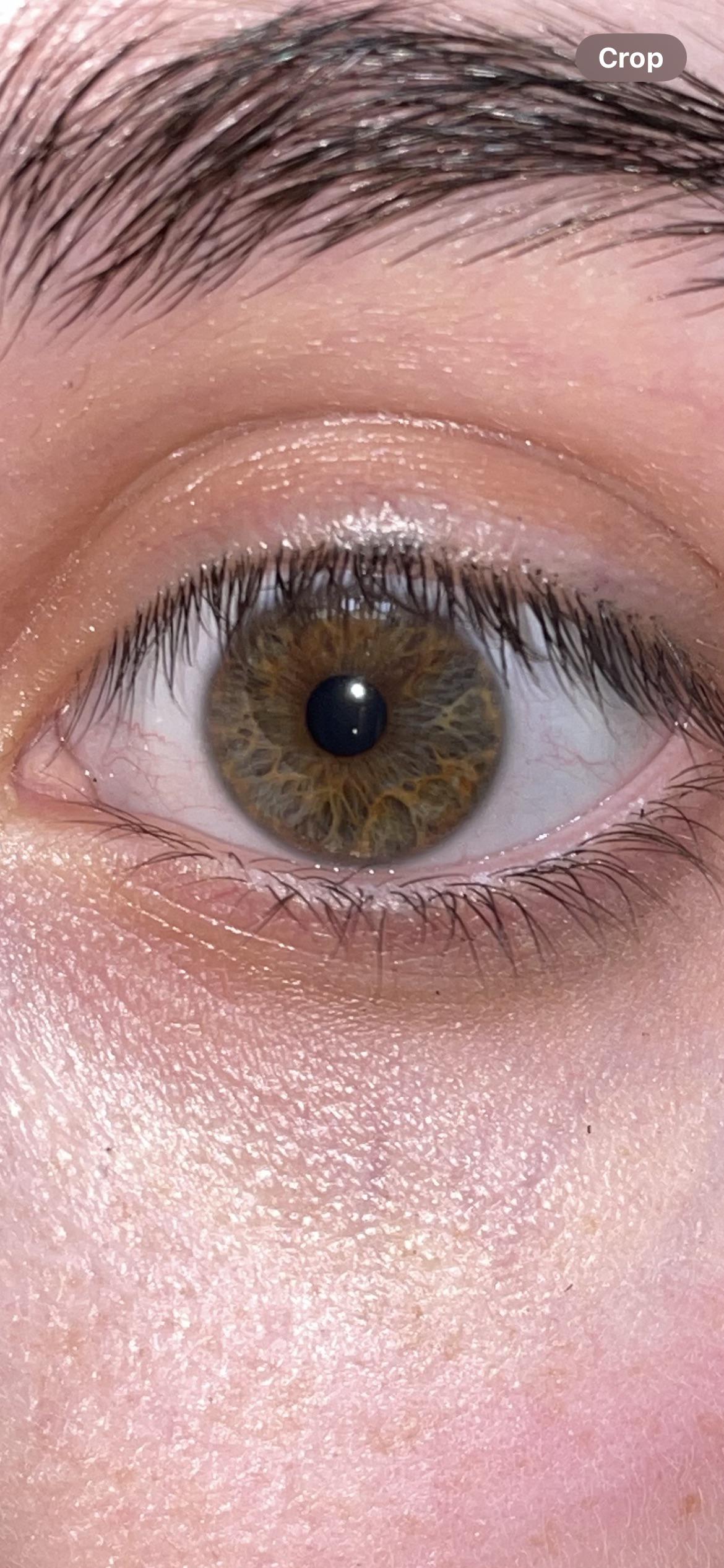 Here’s the other eye | Scrolller