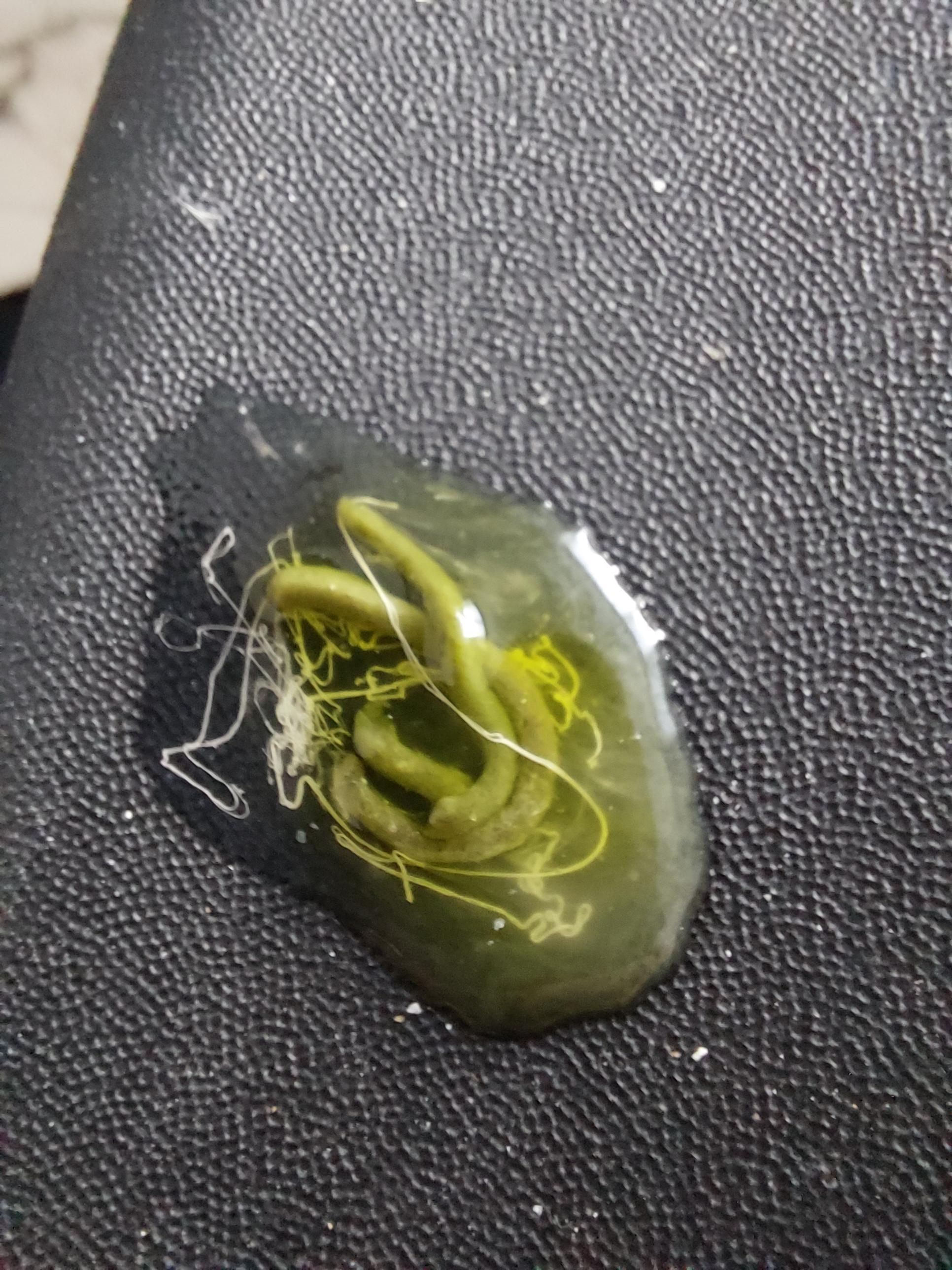 Discover more like Cockatiel: Dear cockatiel lovers, do you have an idea what is wrong with my ...