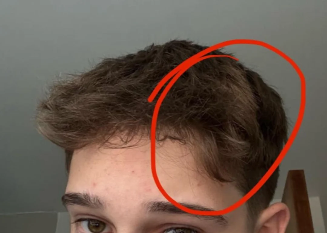 absolutely devastating cowlick, should i grow facial hair and get a buzz cut or grow it out ...