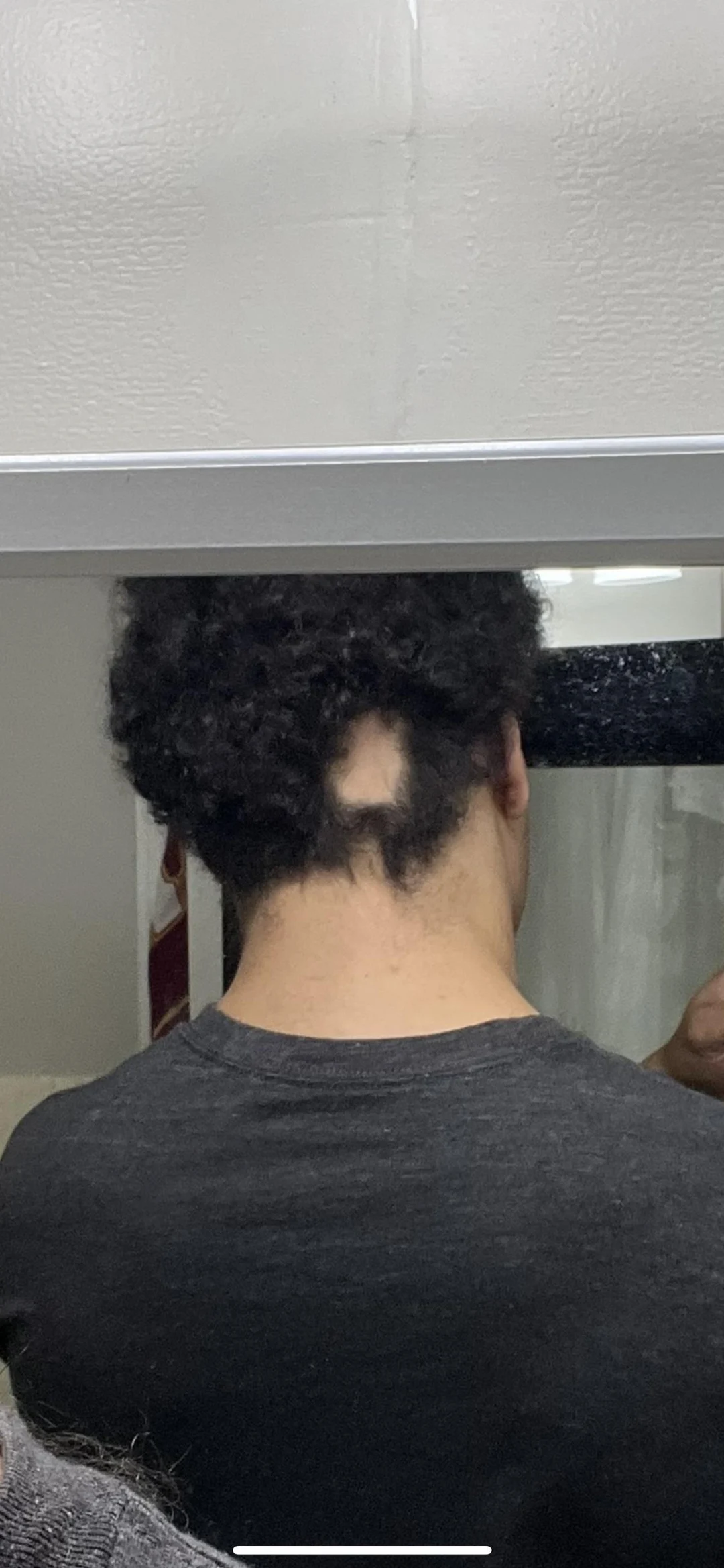 What is this bald spot. | Scrolller