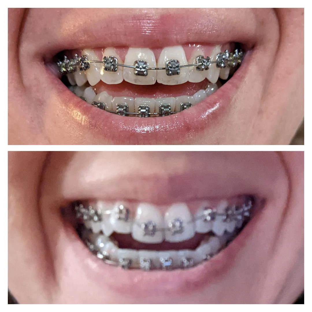 Day 1 (bottom) & My First Follow-Up and Second Wire! | Scrolller