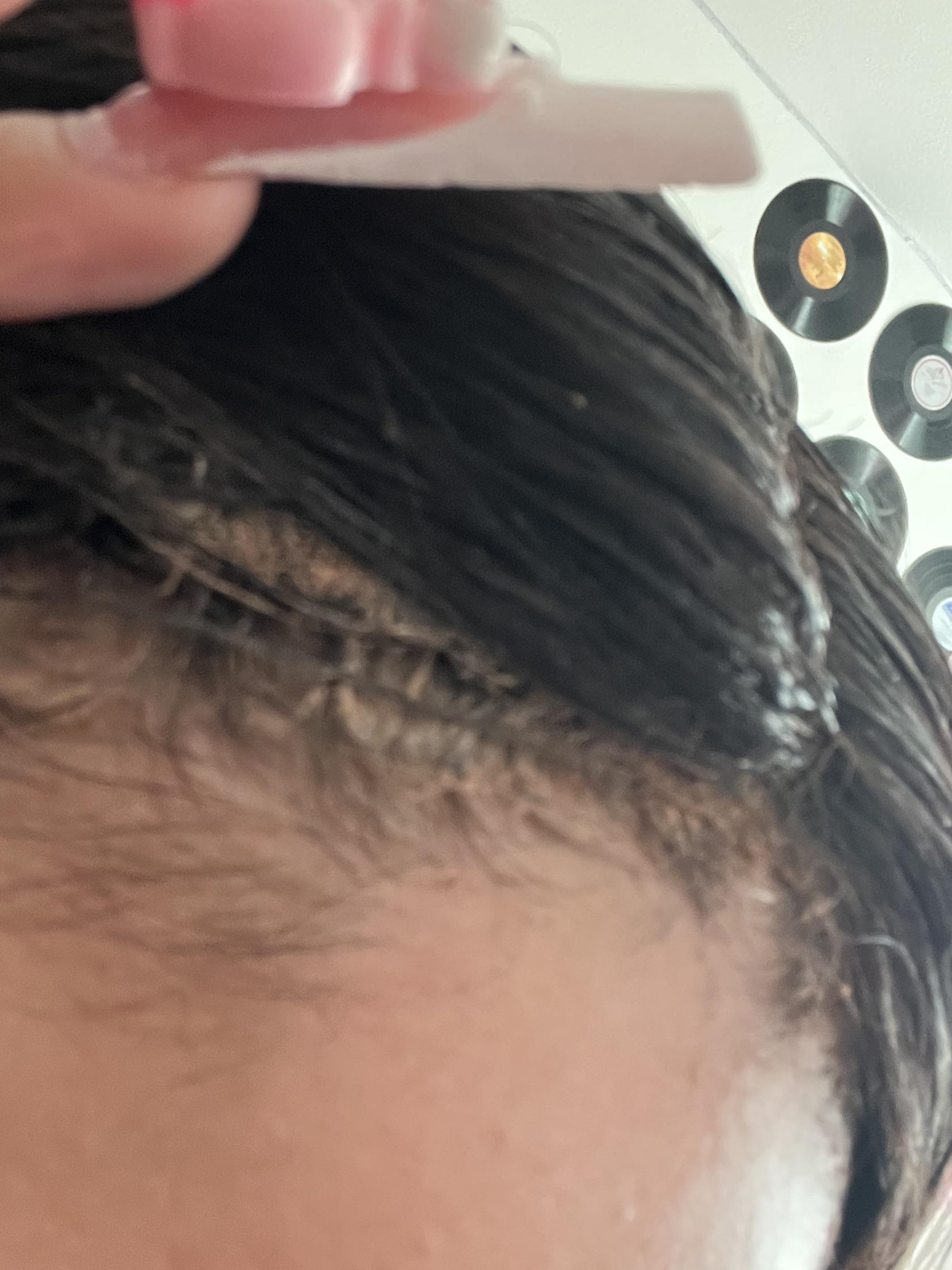 Is this normal? | Scrolller