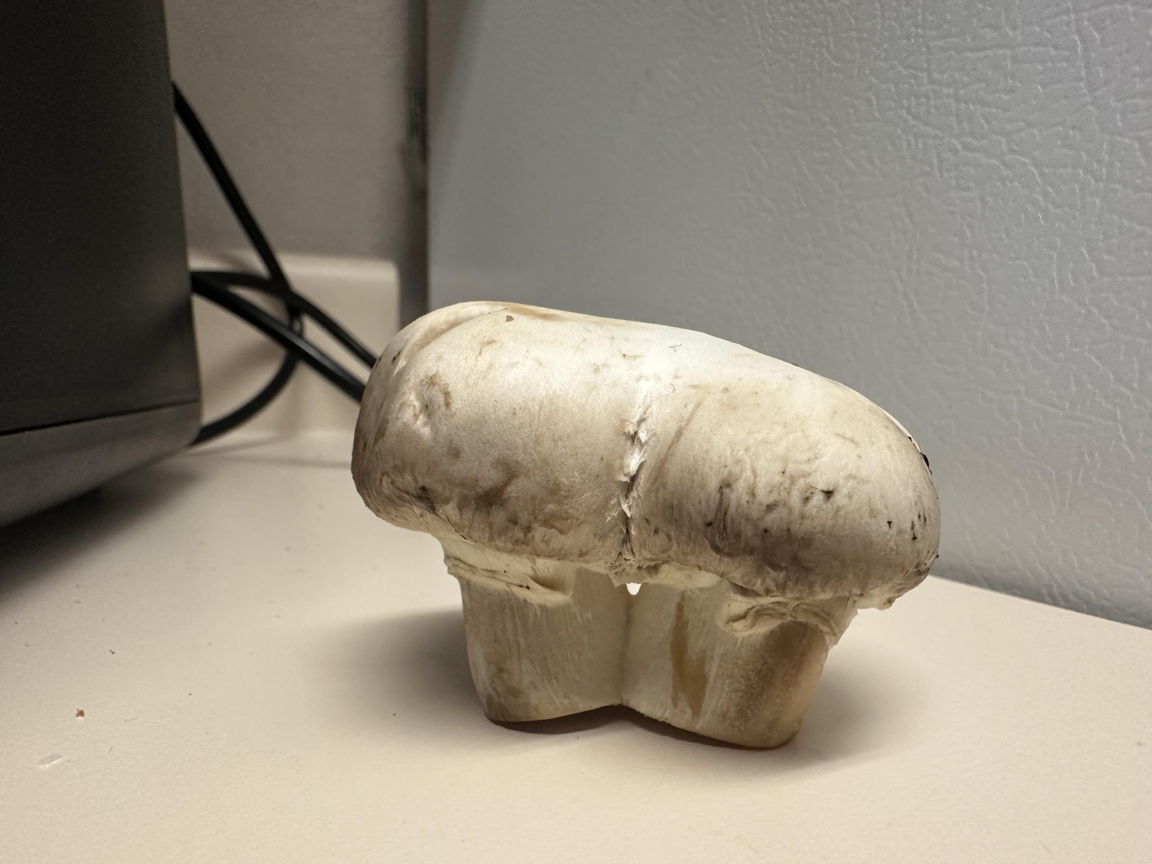 Conjoined Twins | Scrolller