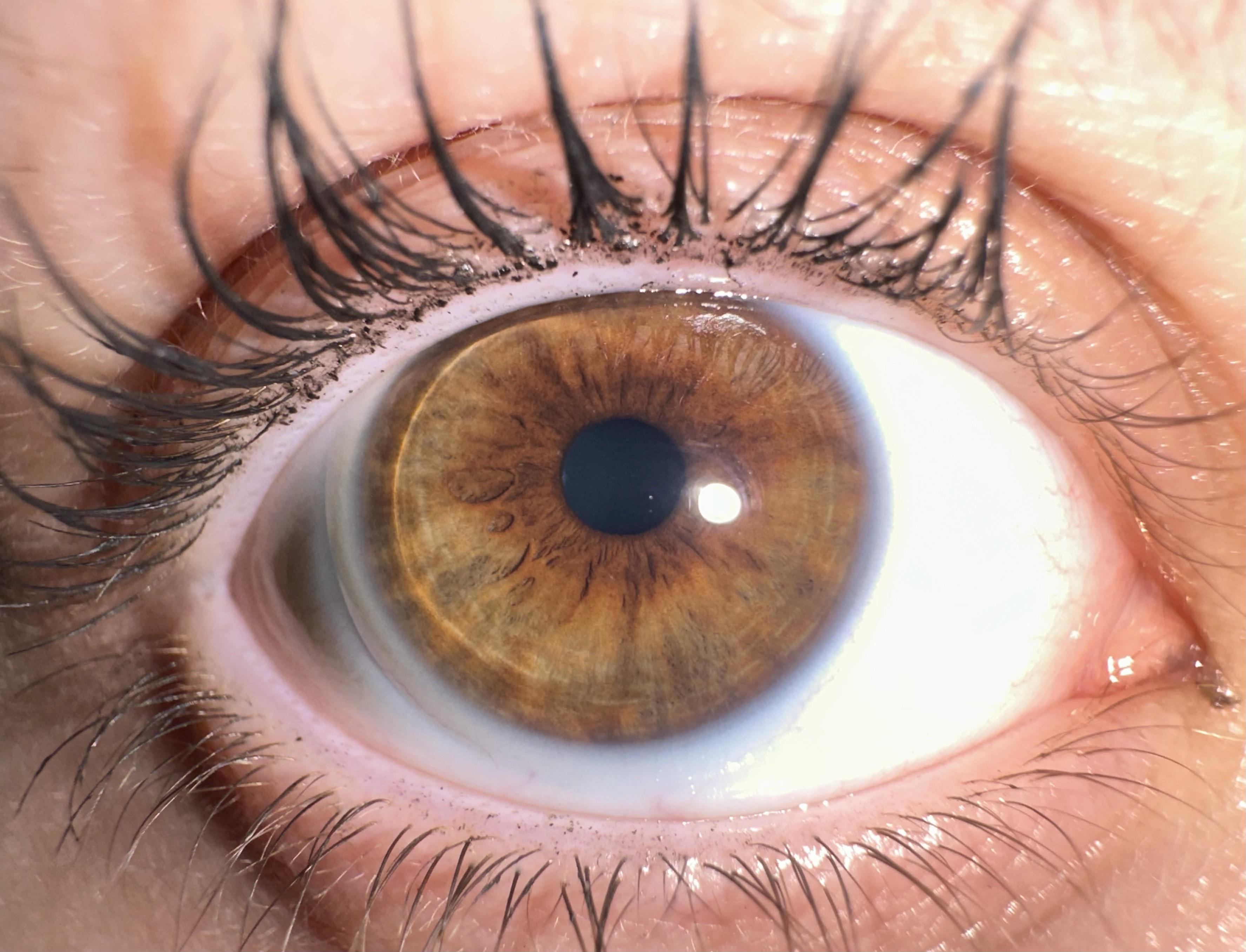 Never could figure out if they were hazel, amber or light brown | Scrolller