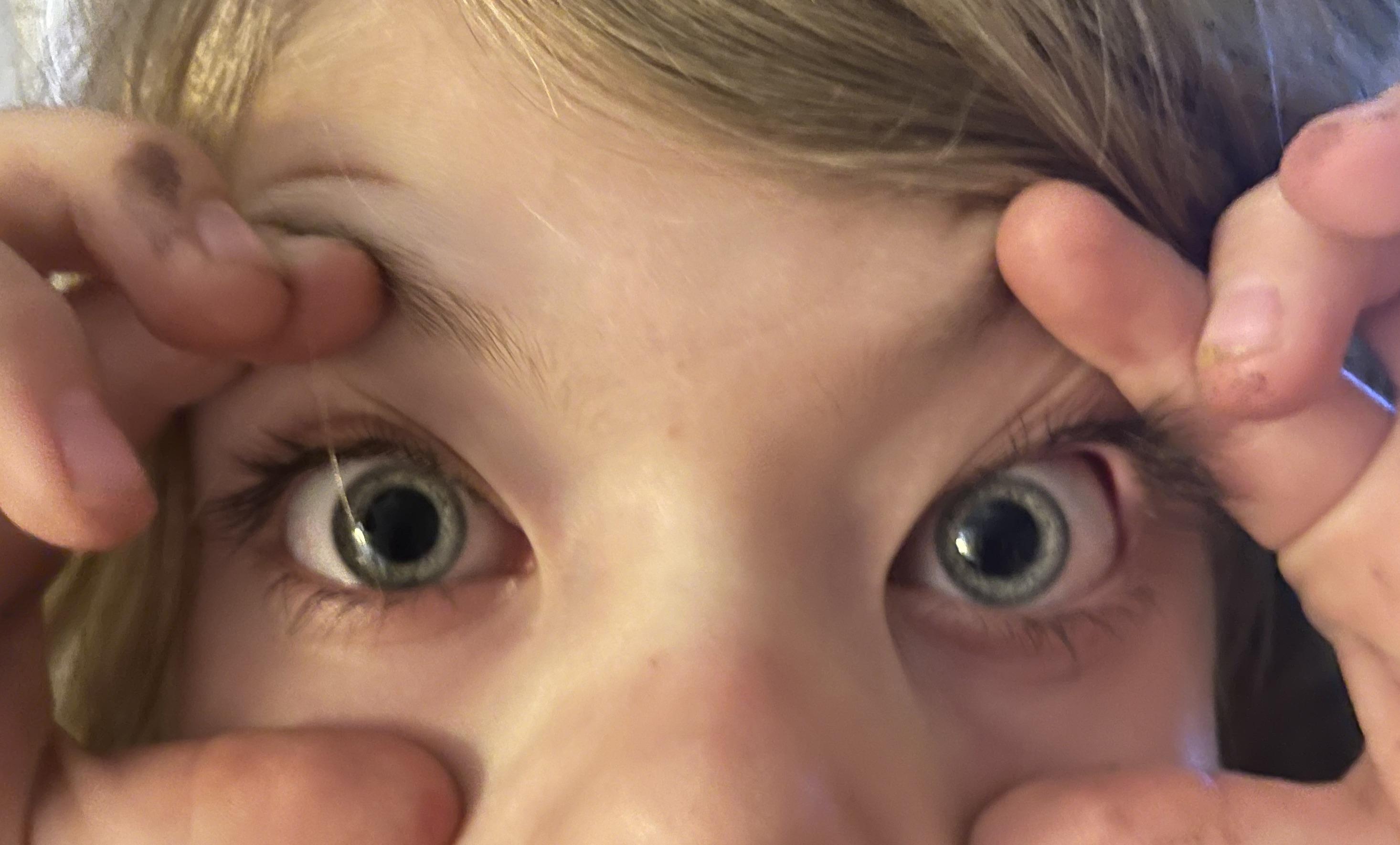 Are my daughters eyes slightly different shades or am I tripping? | Scrolller