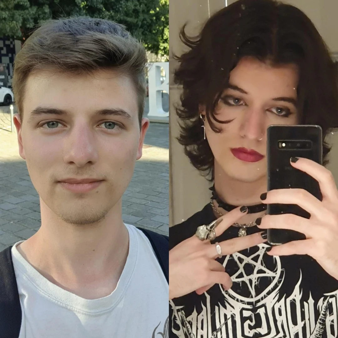 one and a half years later. Improvement? | Scrolller