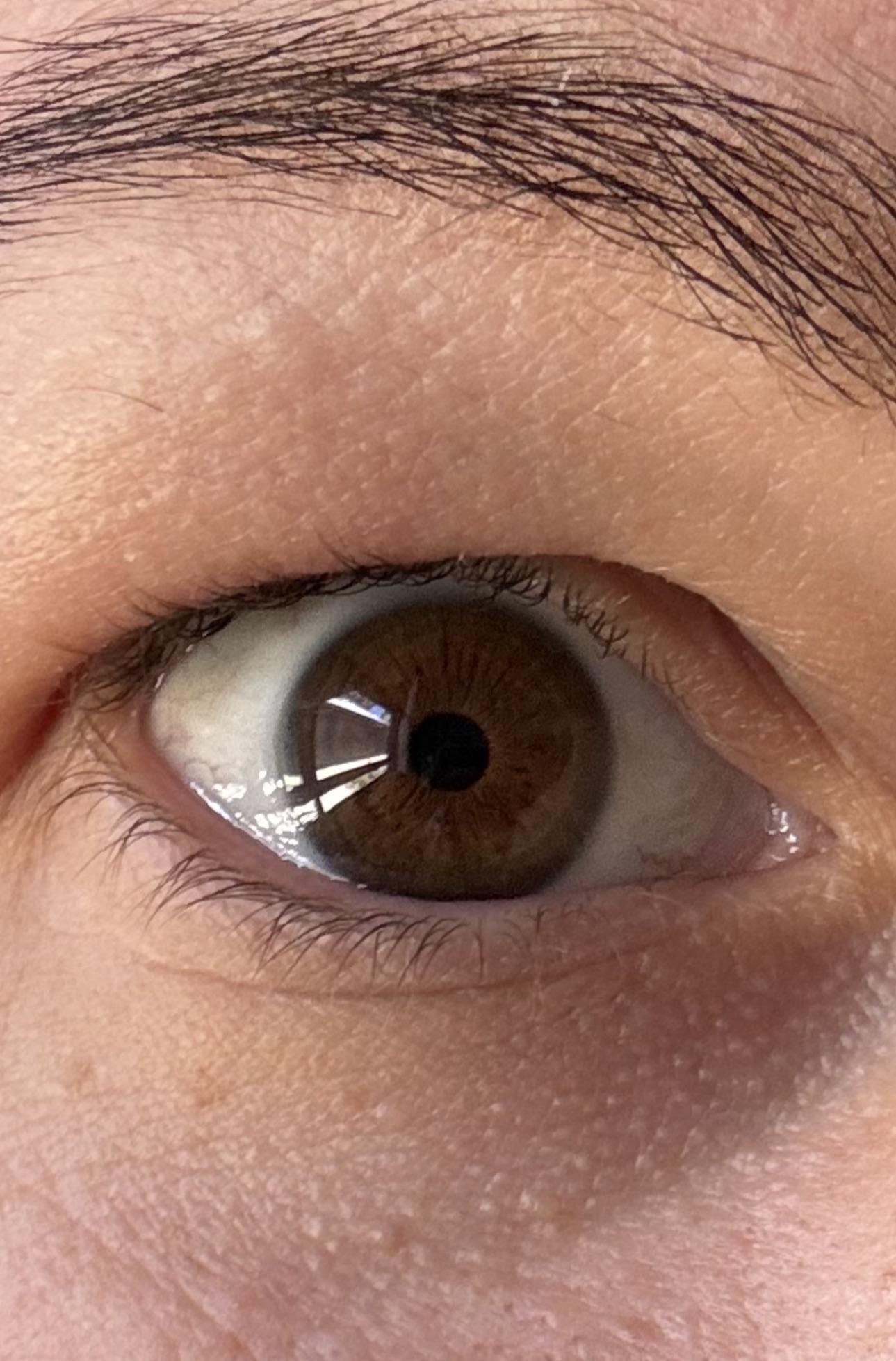 Genetics | Scrolller