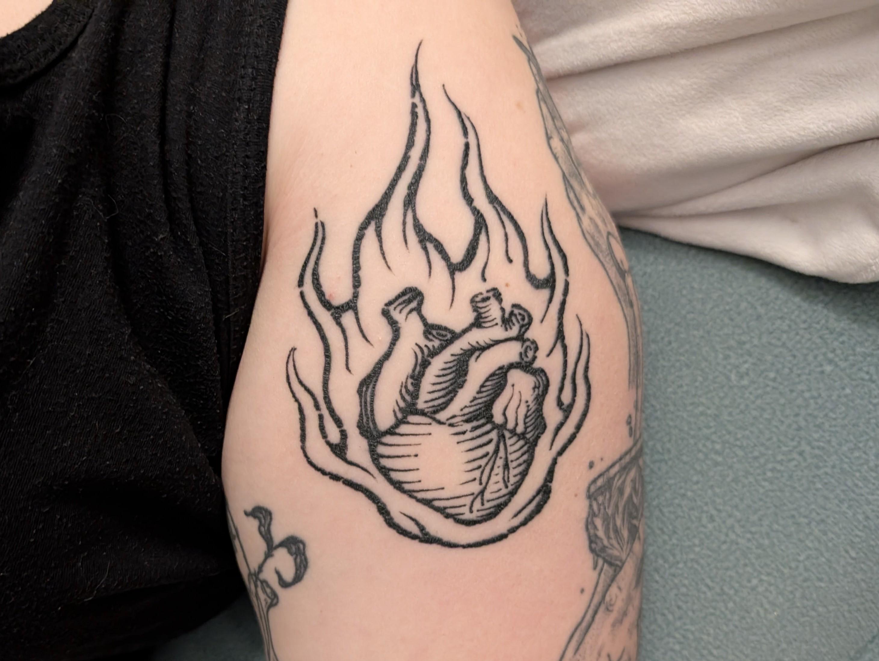 Still raised lines? | Scrolller