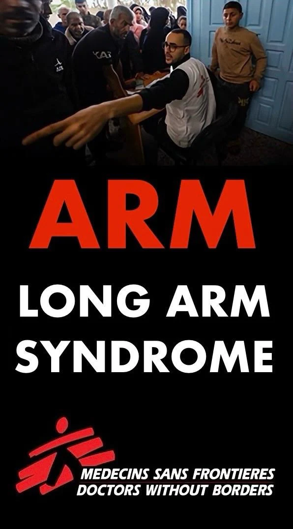 ARM | Scrolller