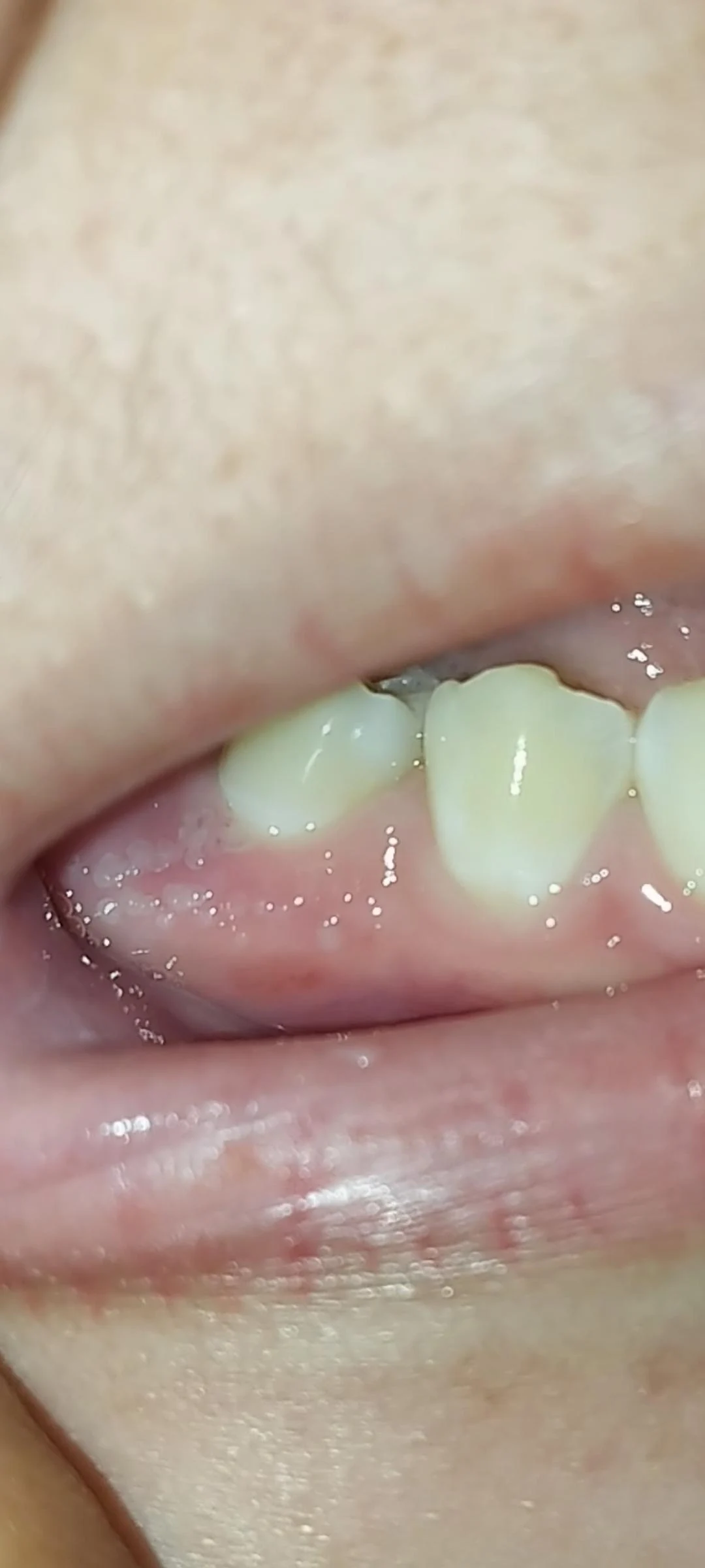 Pls help, what are these white spots? | Scrolller