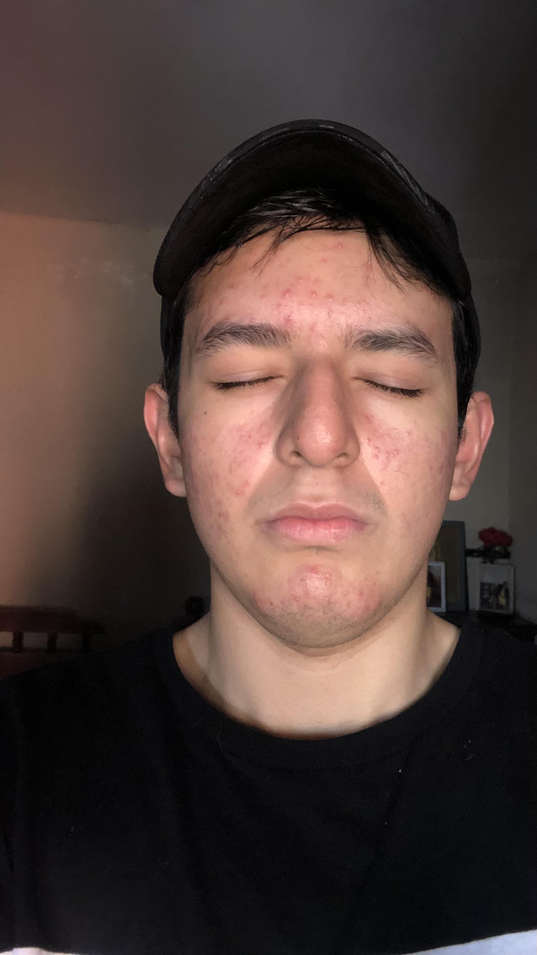 Is this normal? | Scrolller